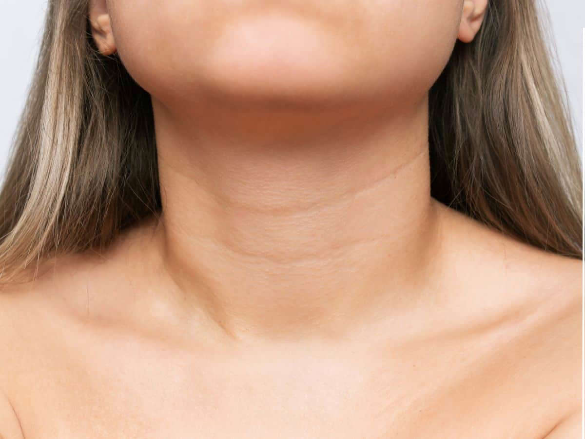 How To Reduce Neck Lines And Wrinkles With These Simple 5 Tricks How To Reduce Neck Lines And Wrinkles With These Simple 5 Tricks