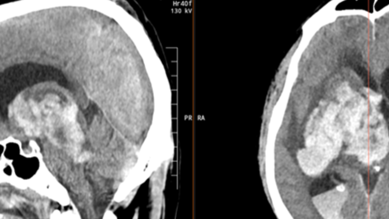 'Party Without Alcohol, You Won't Lose Anything': Liver Doc Warns And ... 'Party Without Alcohol, You Won't Lose Anything': Liver Doc Warns And ...