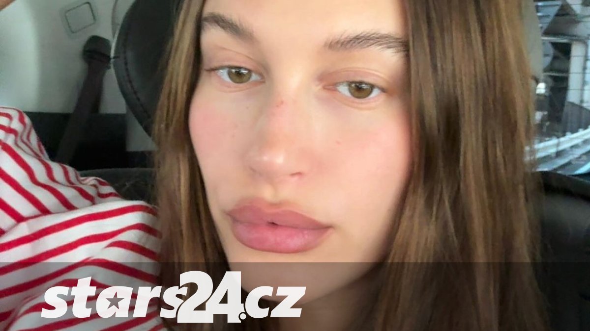 Hailey Bieber čelí zdravotním problémům. Její stav zhoršují finanční ...