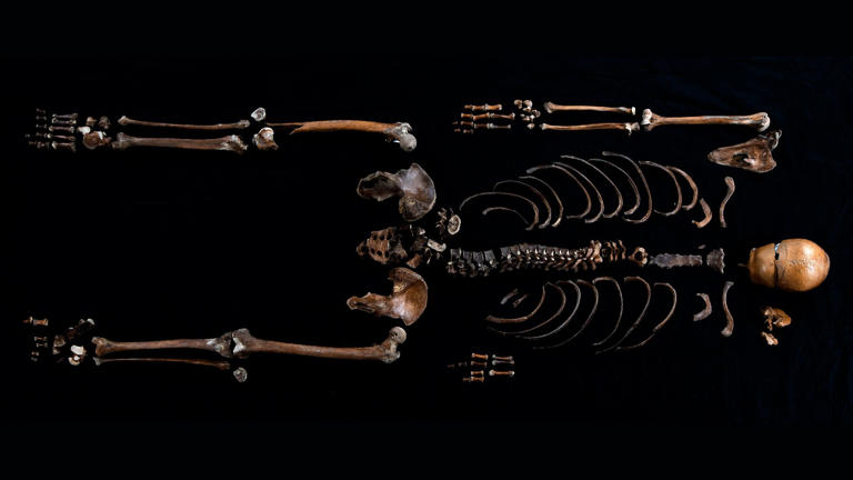 DNA analysis of medieval man thrown into a well suggests story in Norse ... DNA analysis of medieval man thrown into a well suggests story in Norse ...