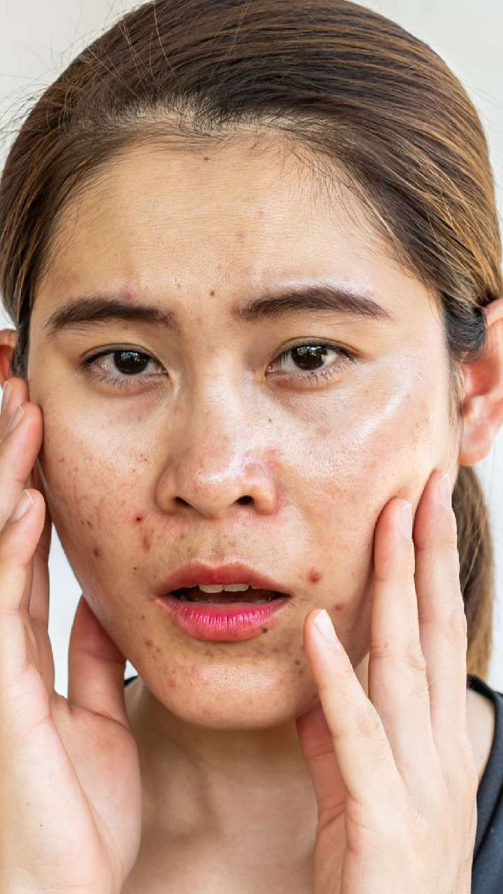 7 Simple Steps To Achieve A Shine-Free Glow For Oily Skin 7 Simple Steps To Achieve A Shine-Free Glow For Oily Skin