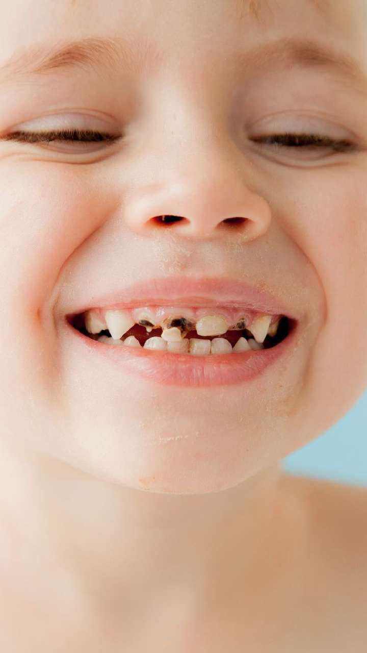 6 Tips To Keep Your Baby's Teeth Healthy 6 Tips To Keep Your Baby's Teeth Healthy