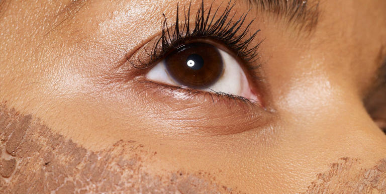 This chemical peel can smooth wrinkle but it's so intense you'll have ...