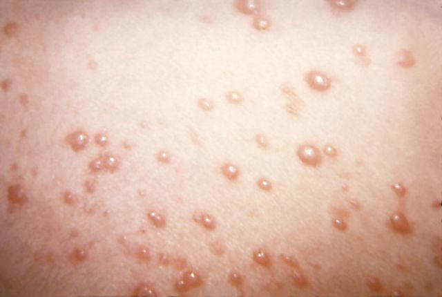14 common causes of skin redness and how to treat them