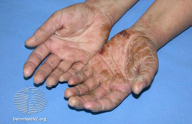 14 common causes of skin redness and how to treat them