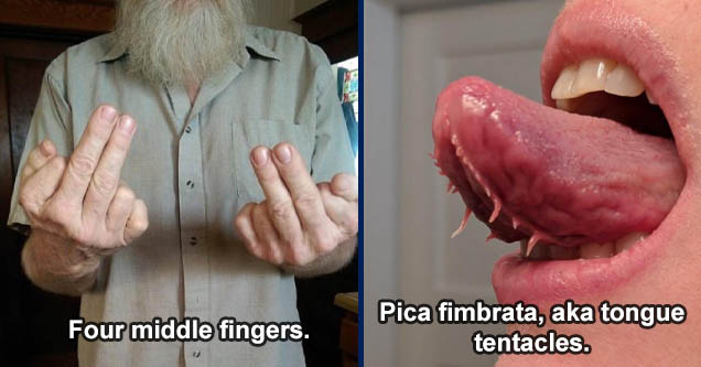 33 Unique People With Unusual Features