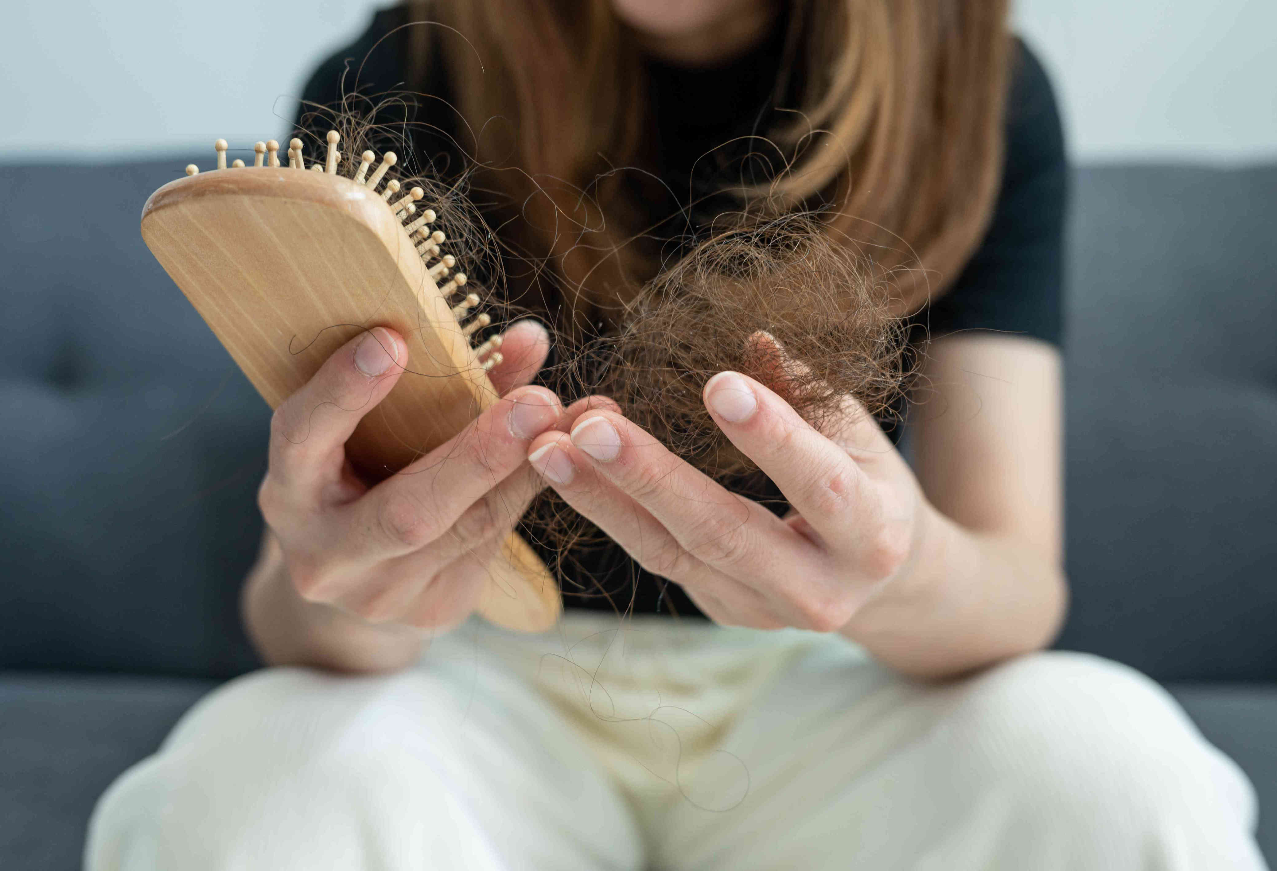 Everything To Know About Telogen Effluvium