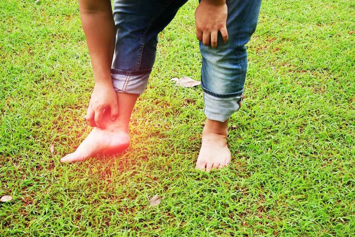 Everything You Should Know About Ant Bites