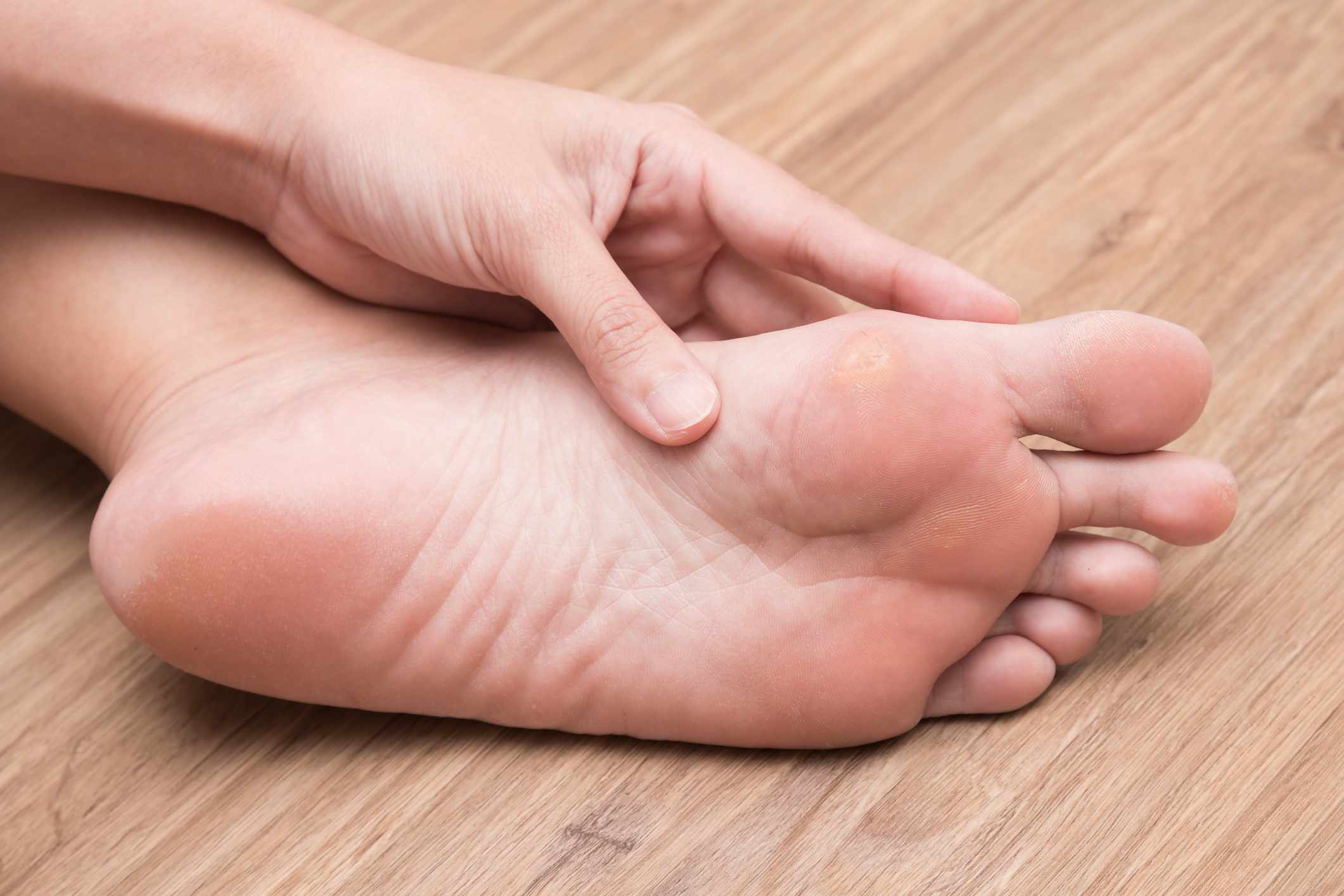 Bump on Toe: Causes and Treatments