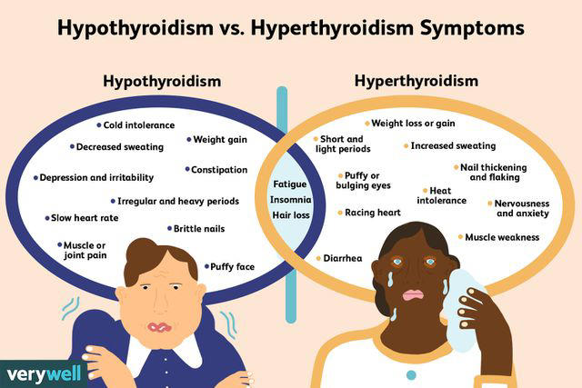Hypothyroidism vs. Hyperthyroidism: What's the Difference?