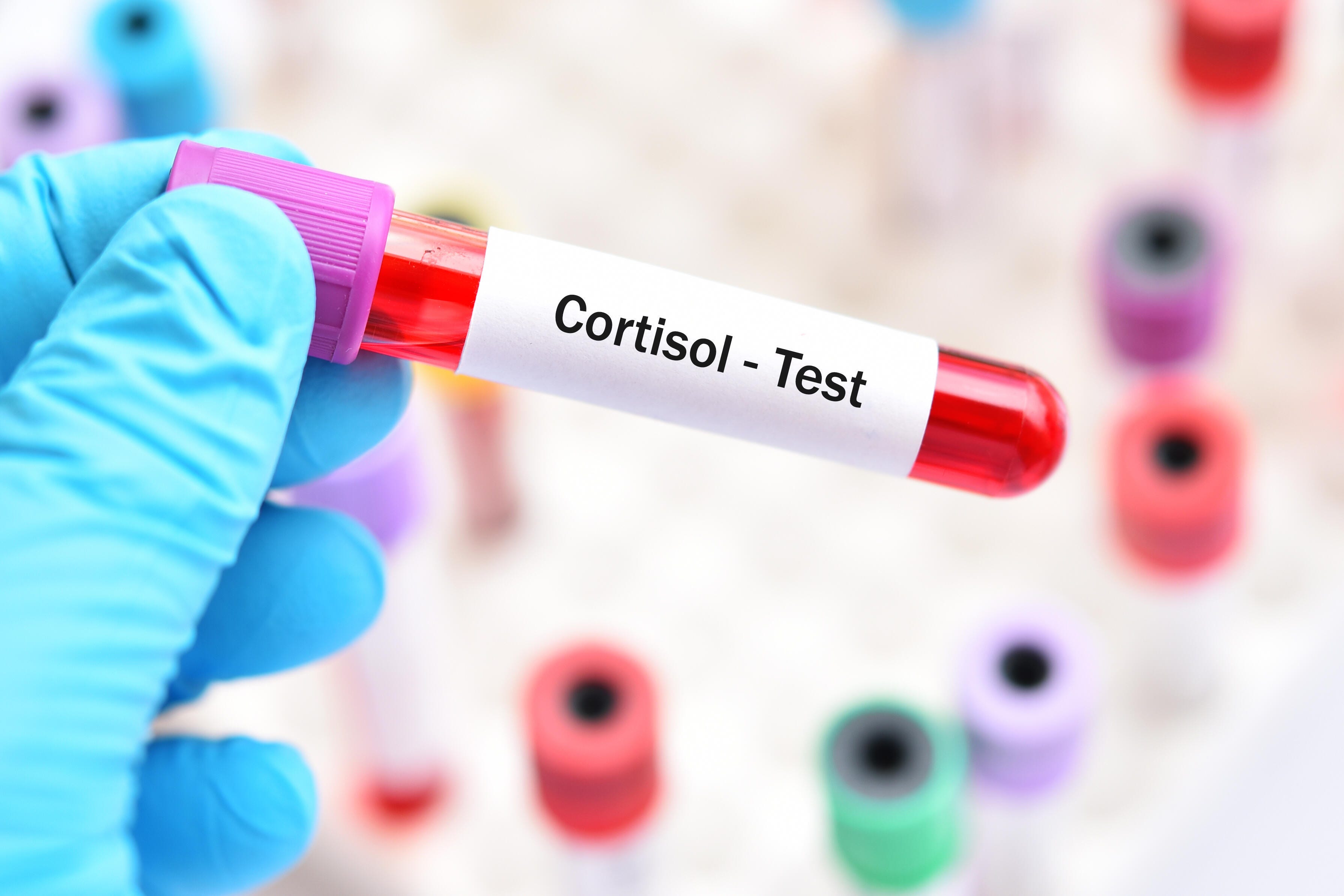 I Got a Blood Stress Test to Learn More About Cortisol and Its Effects ...