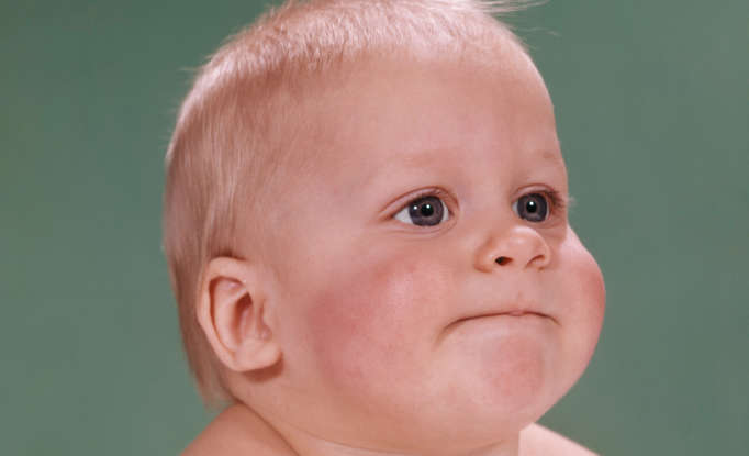 The potential reasons why your face looks swollen The potential reasons why your face looks swollen