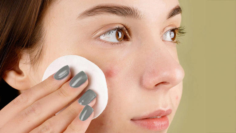 Macchie sulla pelle: trattamenti naturali e prodotti ecobio