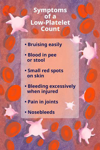 Causes and symptoms of a low platelet count (thrombocytopenia)