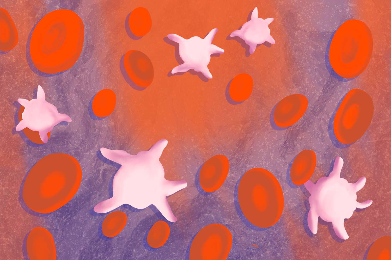 Causes and Symptoms of a Low Platelet Count (Thrombocytopenia)