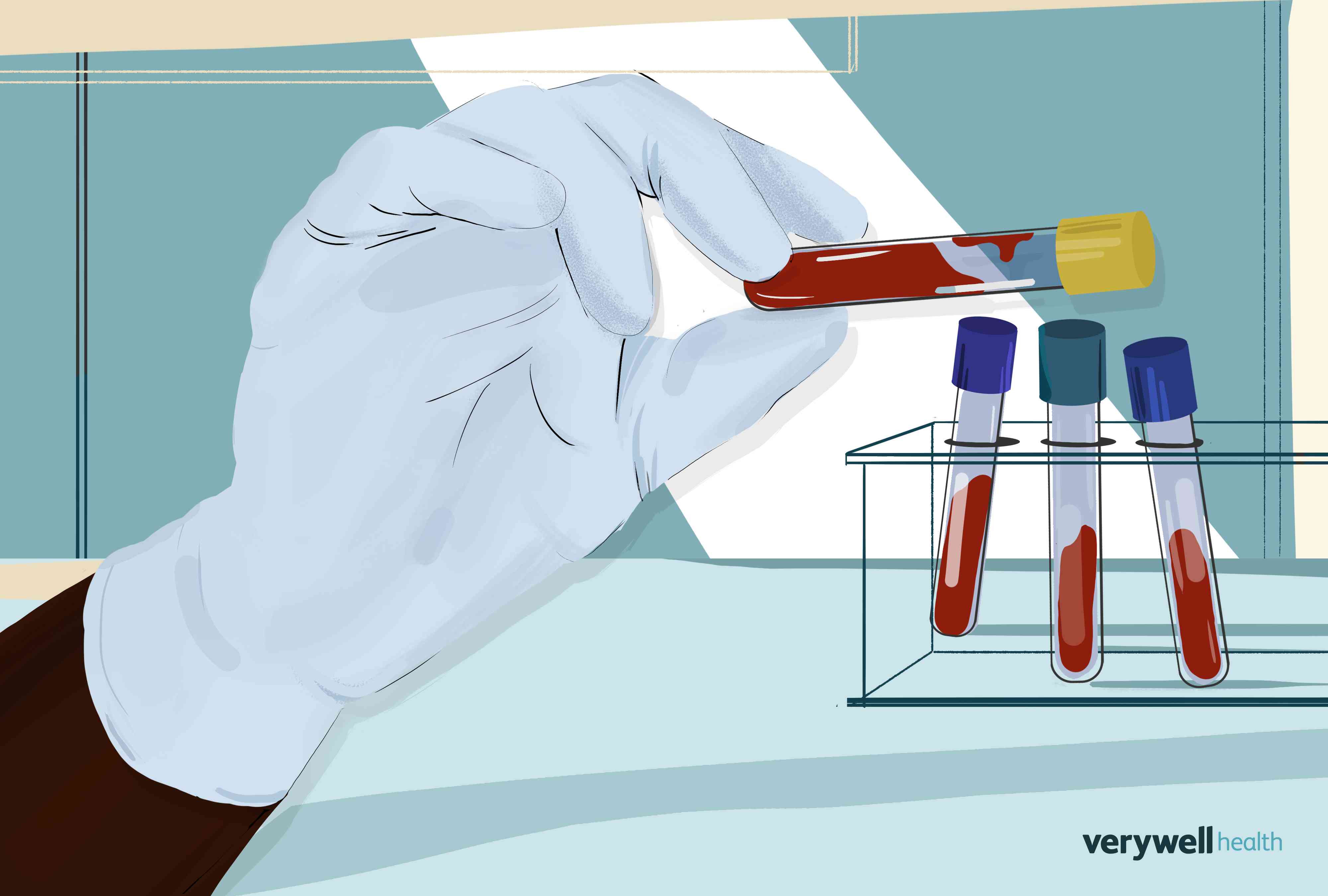 Understanding female hormone panels