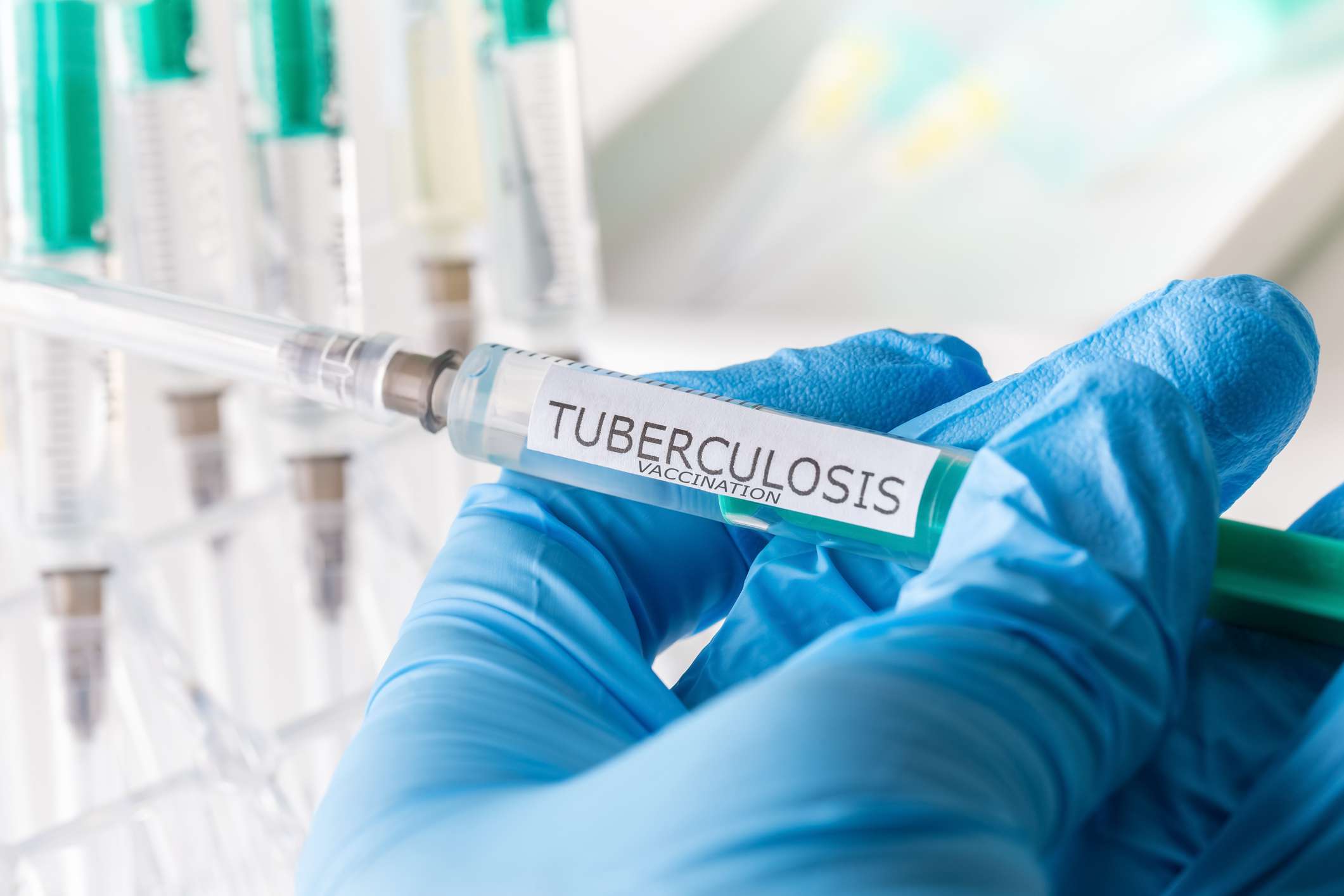 Everything You Need to Know About the Tuberculosis Vaccine