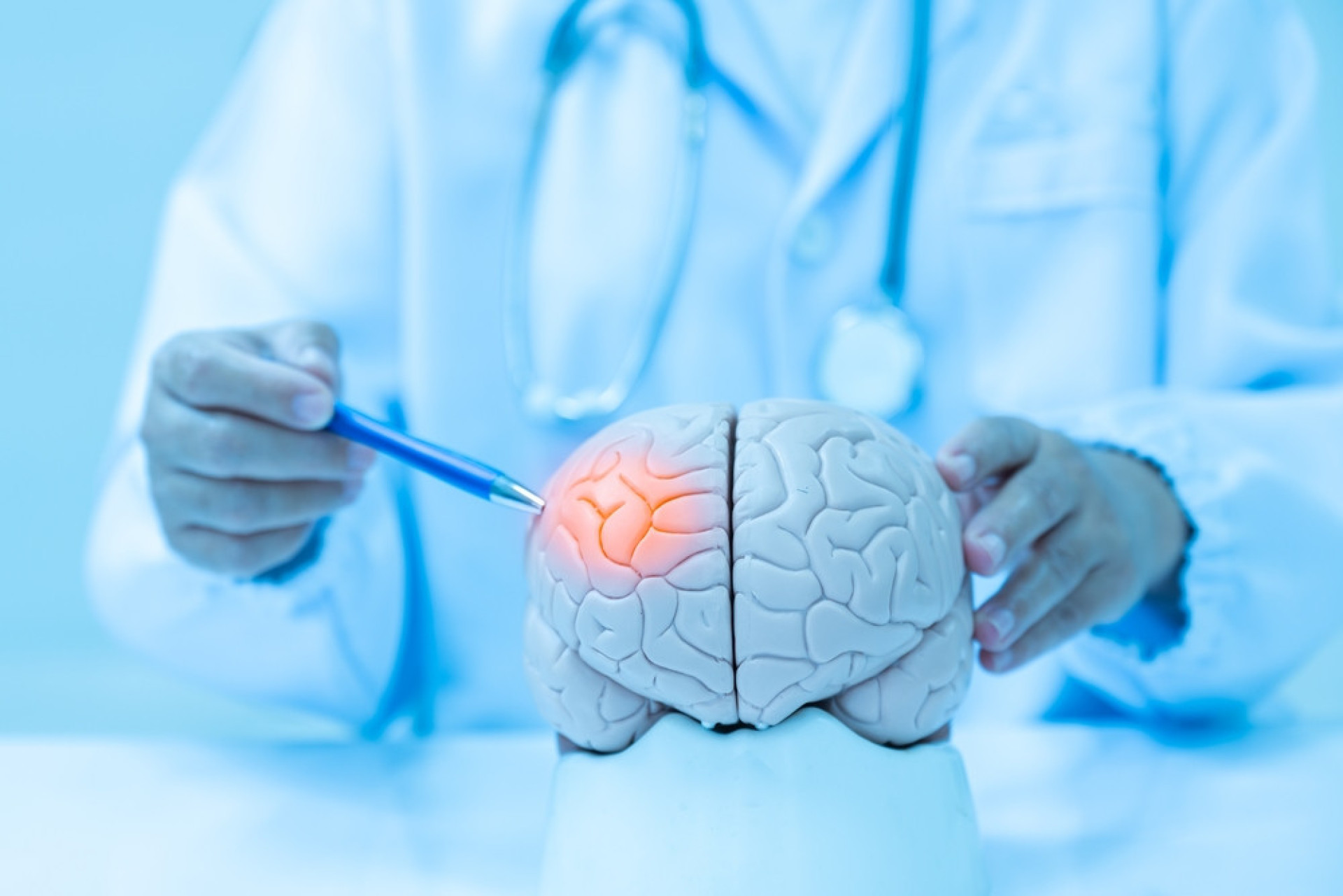Ictus in forte aumento tra i giovani adulti, ecco perché