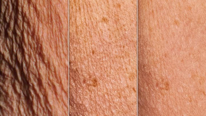 I Shop Online For A Living, And LYMA's Rare Laser Sale Is The Best Early Black Friday Deal I've ...