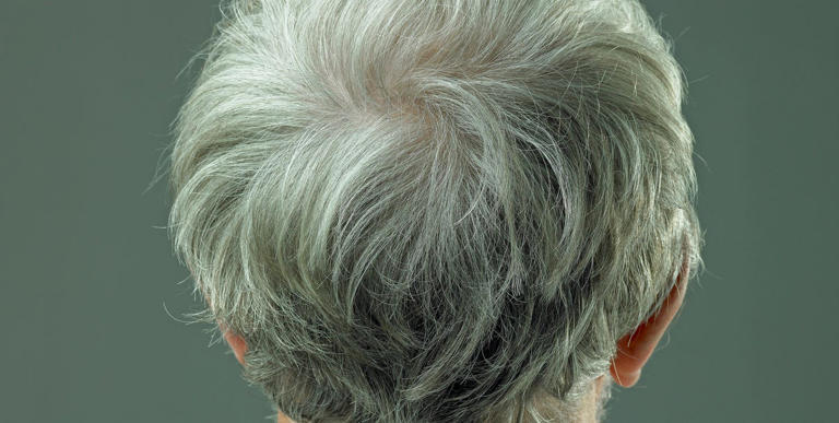 A Study Says Gray Hair May Be Reversible