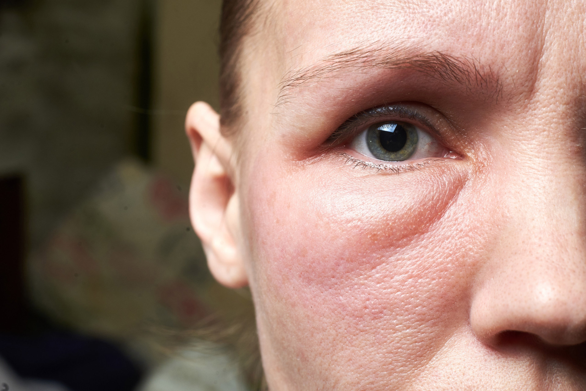 The potential reasons why your face looks swollen The potential reasons why your face looks swollen