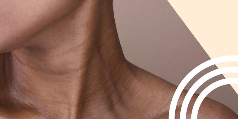 How To Treat An Aging Neck—Without Surgery