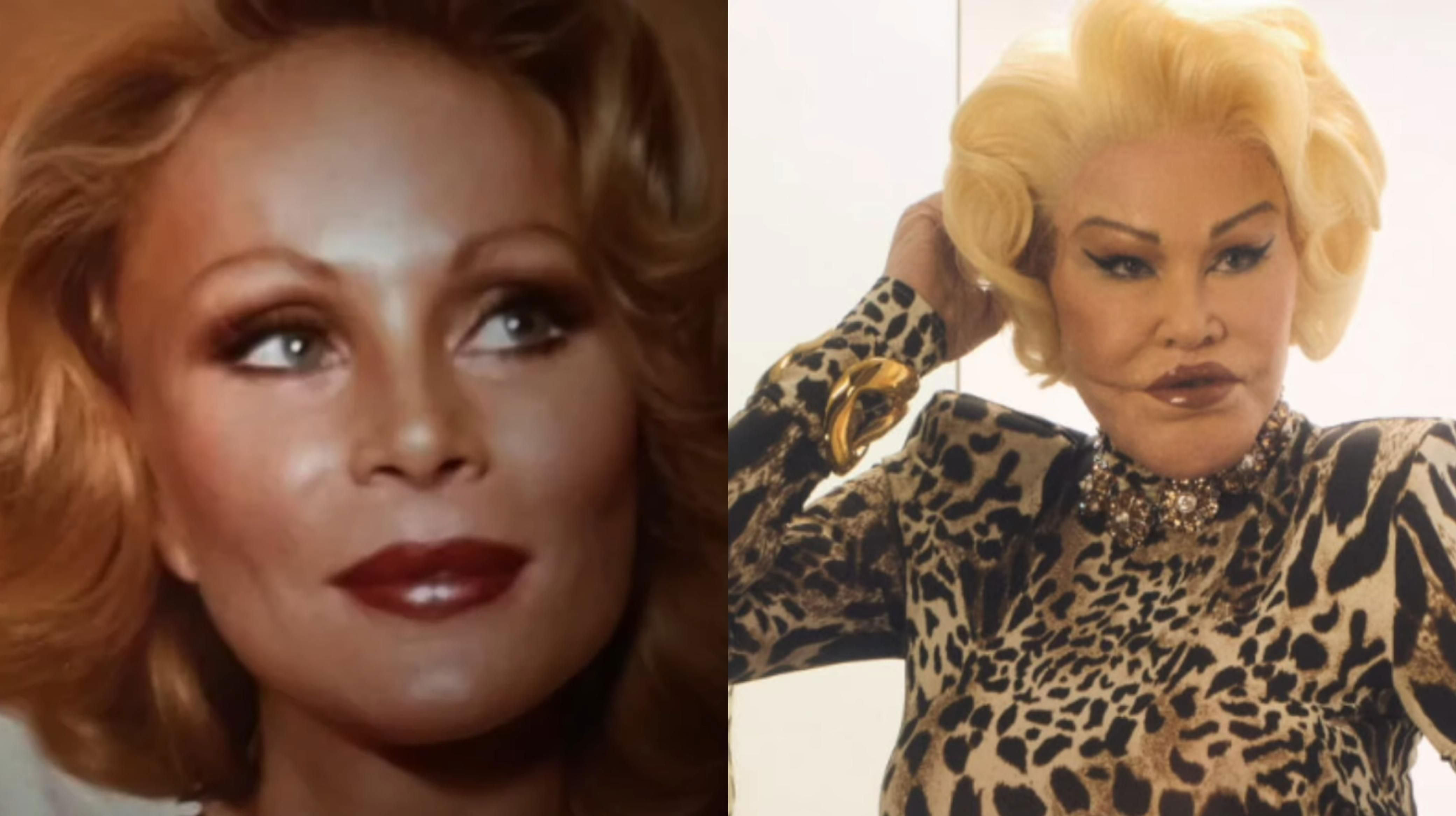 20 times botched plastic surgeries left celebrities unrecognizable 20 times botched plastic surgeries left celebrities unrecognizable