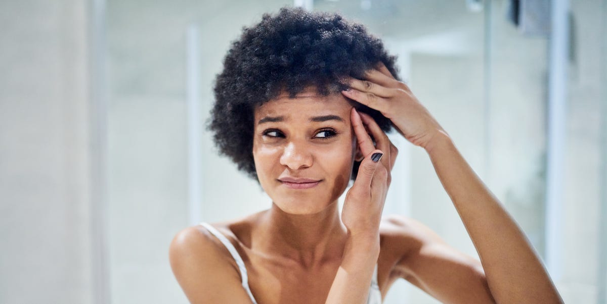 How to Get Rid of Scalp Acne Permanently, According to Dermatologists