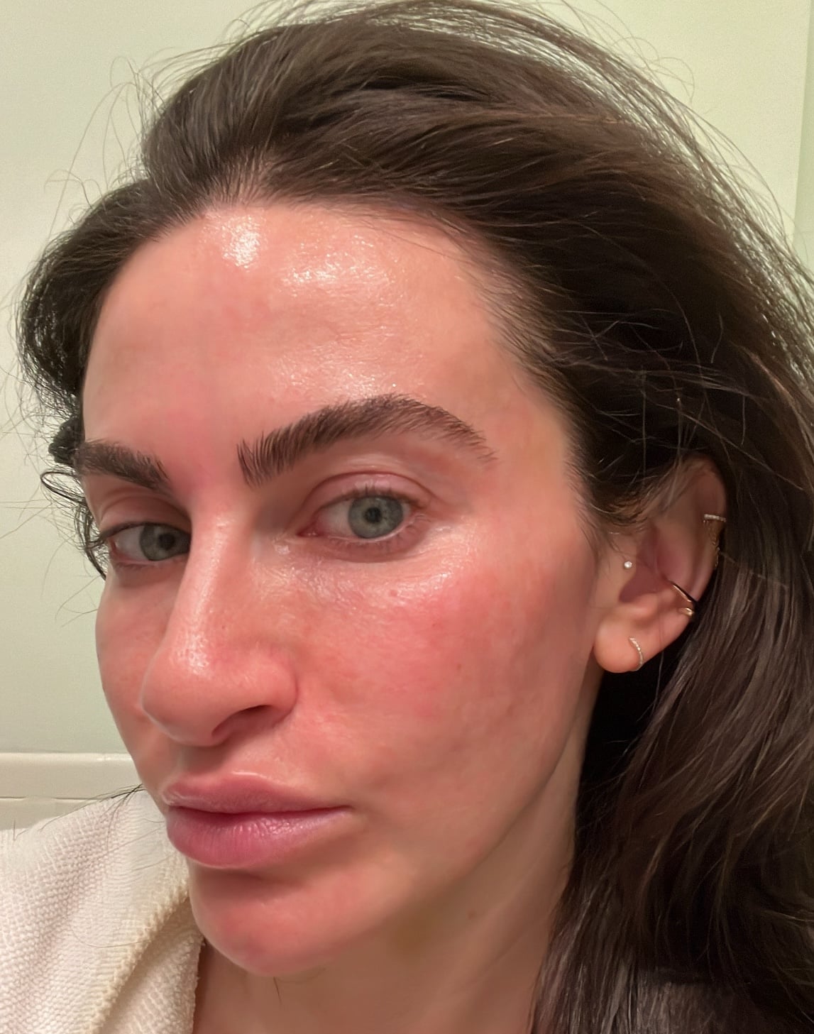 I’m Obsessed With This Viral Micro-Needling System, and It’s on Sale