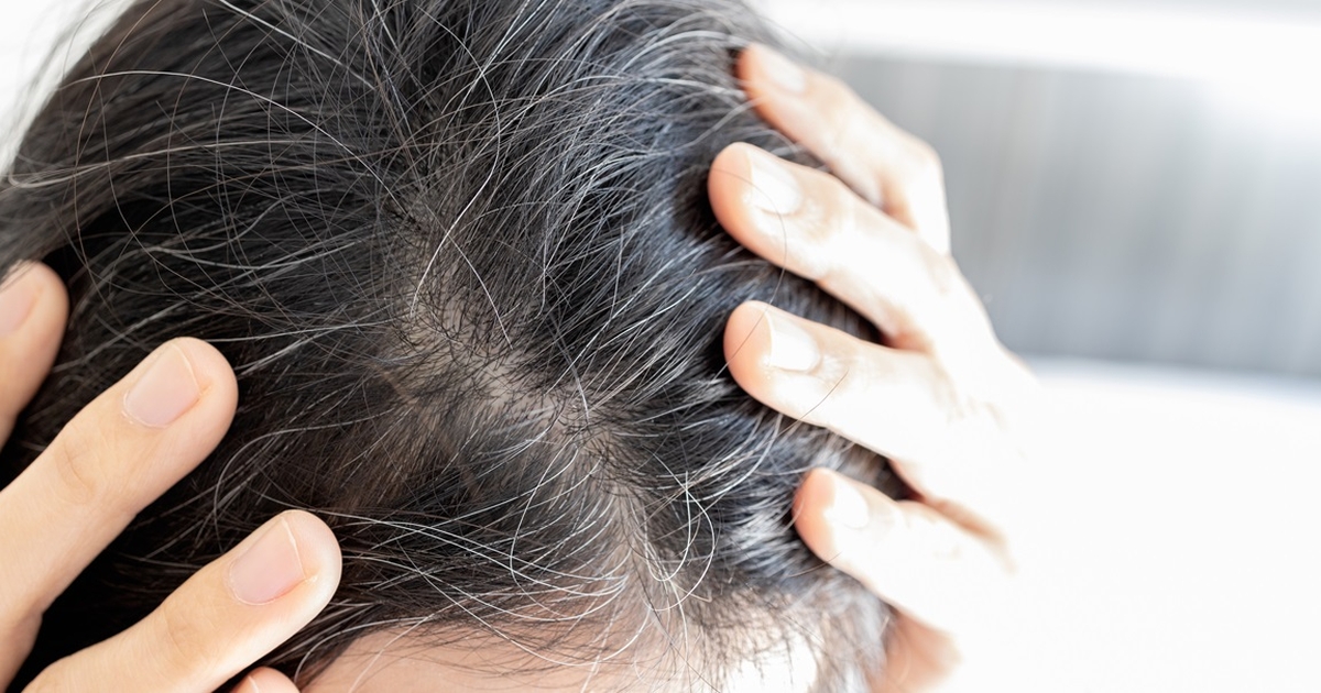 Hjælper rosmarinolie virkelig håret med at vokse? Nu giver eksperter ...