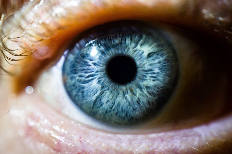 Rare warning sign in your eye could be a symptom of high cholesterol