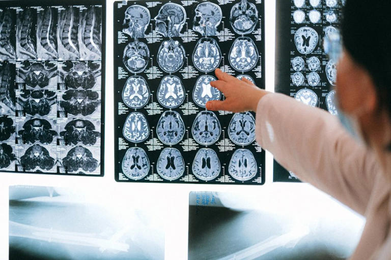 Scientists identify five distinct ages of the human brain