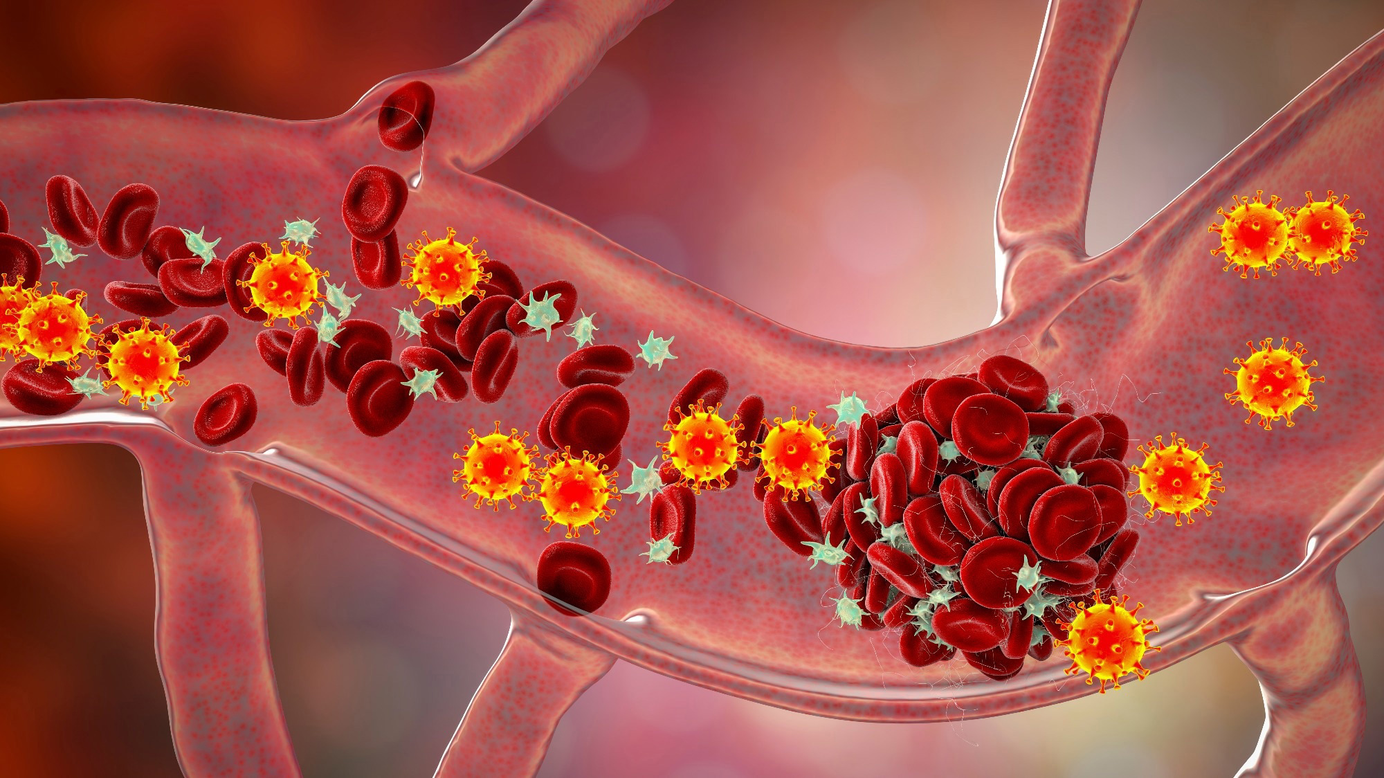 SARS-CoV-2 hijacks cholesterol trafficking to fuel infection and evade ... SARS-CoV-2 hijacks cholesterol trafficking to fuel infection and evade ...