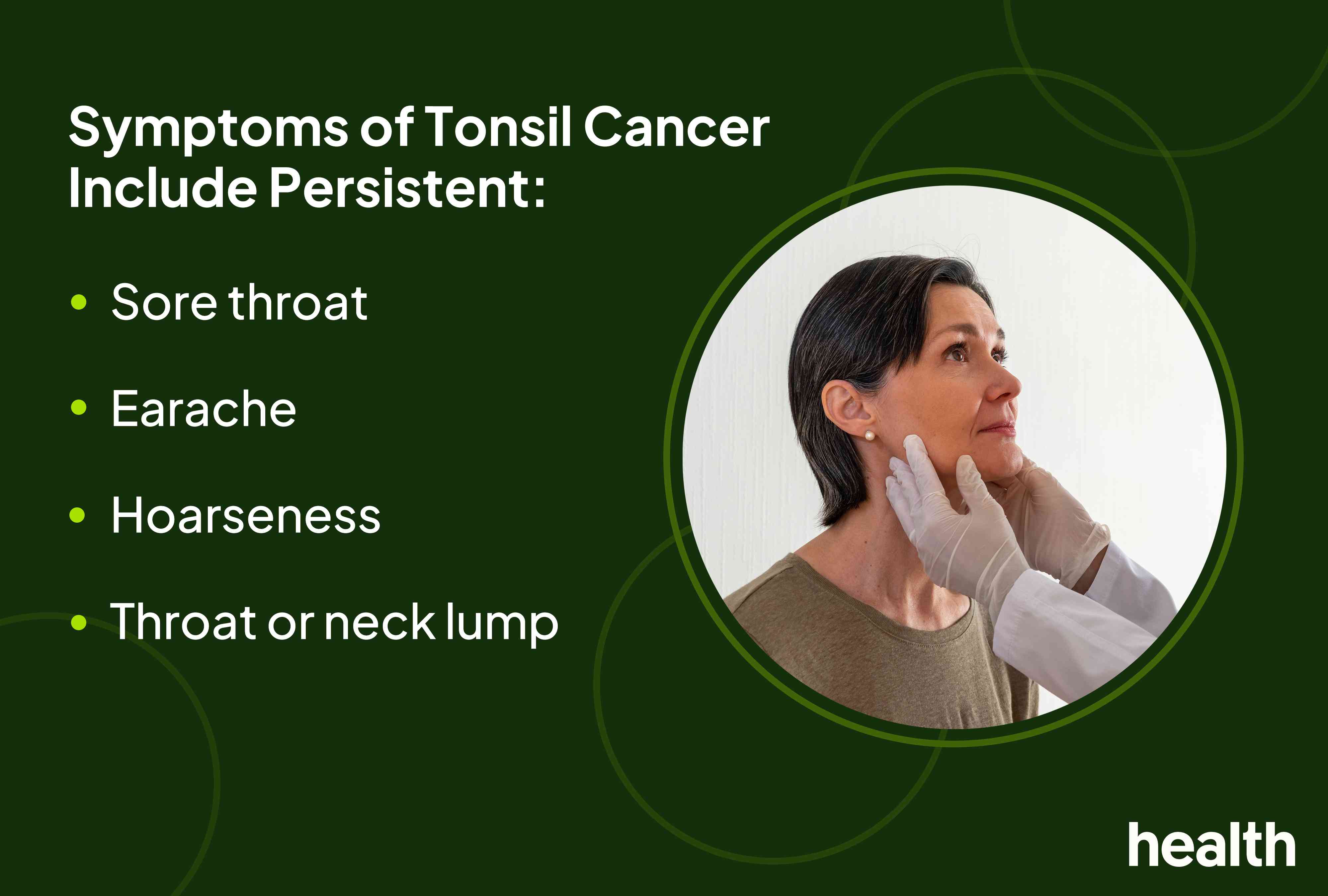 Signs and Symptoms of Tonsil Cancer