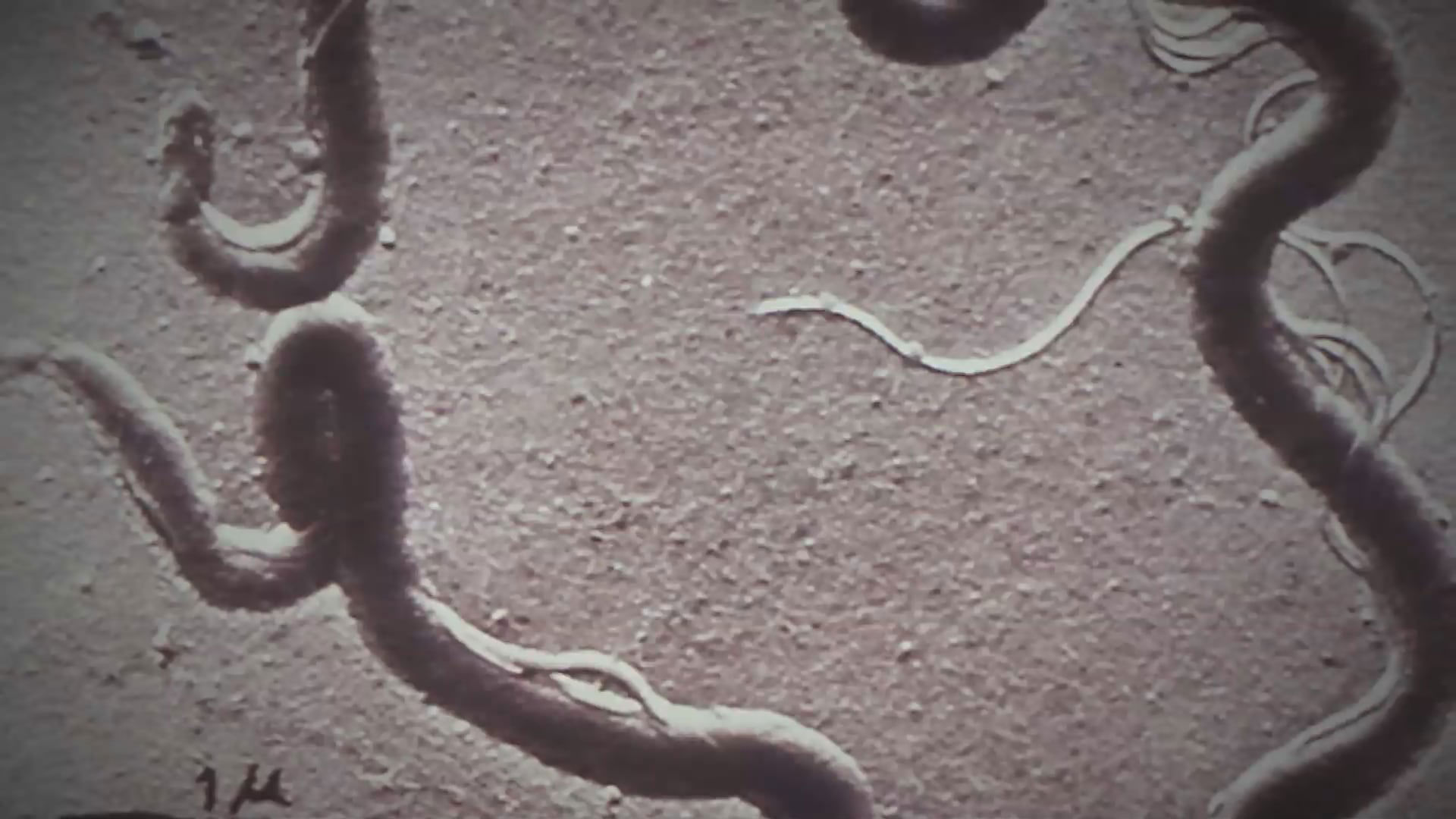 North Carolina has some of the highest STD rates nationwide, report says North Carolina has some of the highest STD rates nationwide, report says