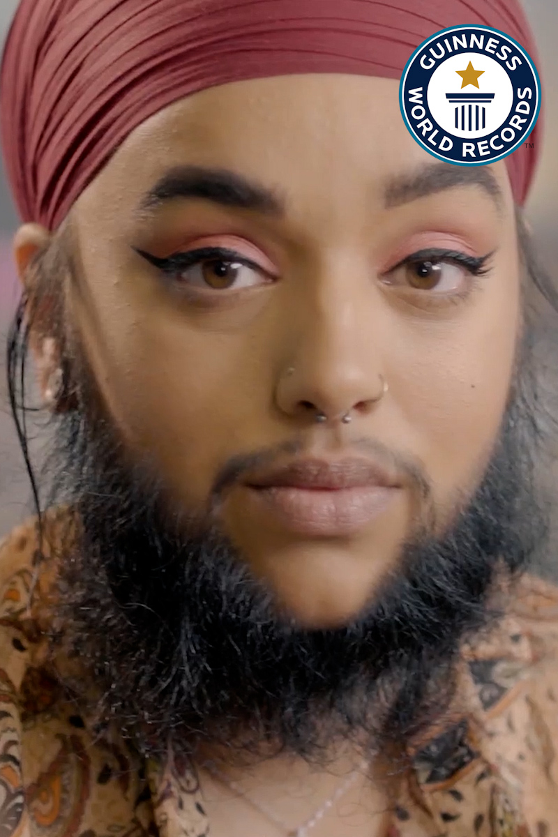 Embracing uniqueness, a bearded lady's perspective