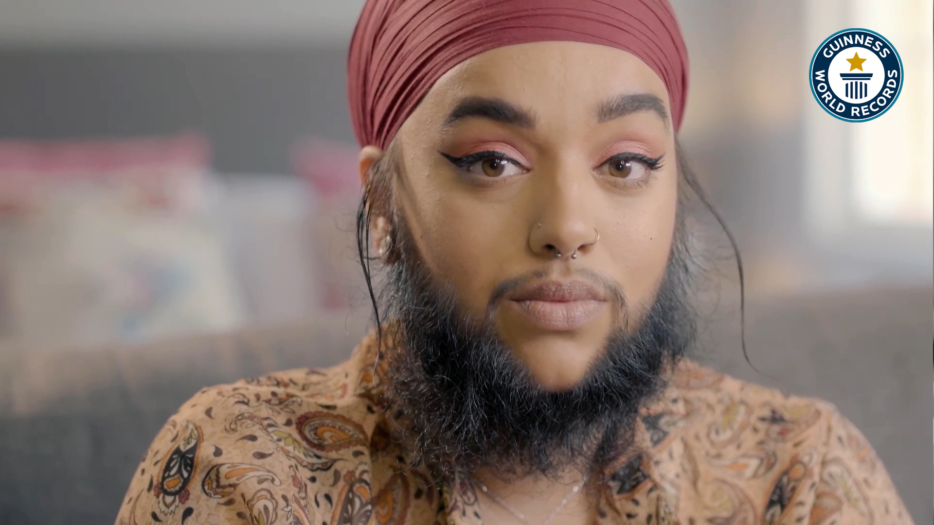 Embracing uniqueness, A bearded lady's perspective