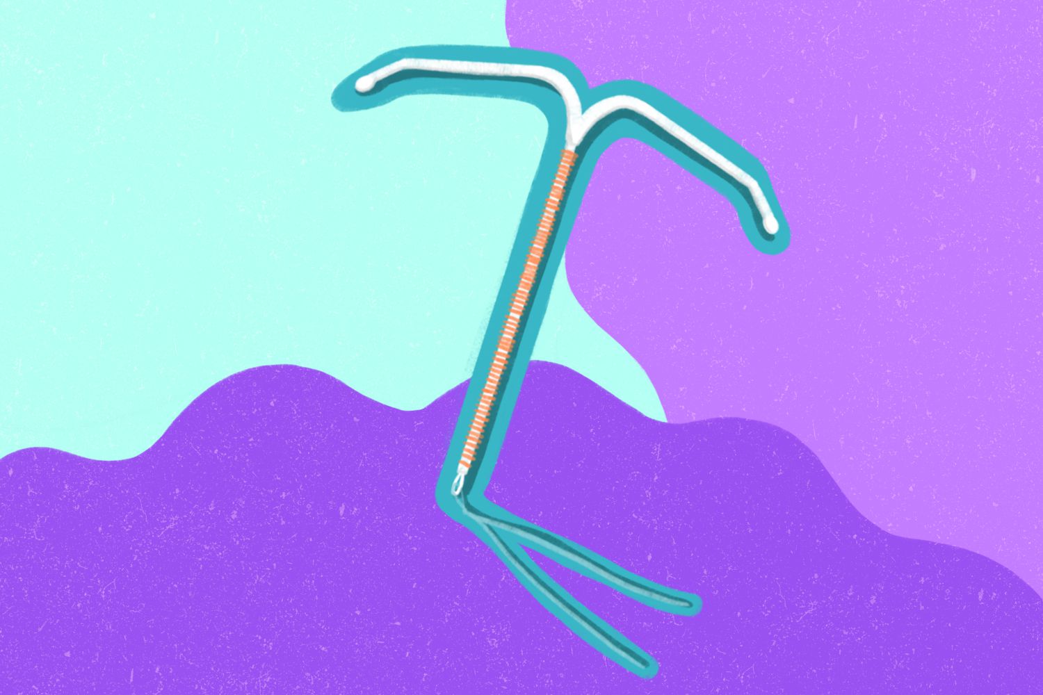 Can You Become Pregnant With an IUD In?