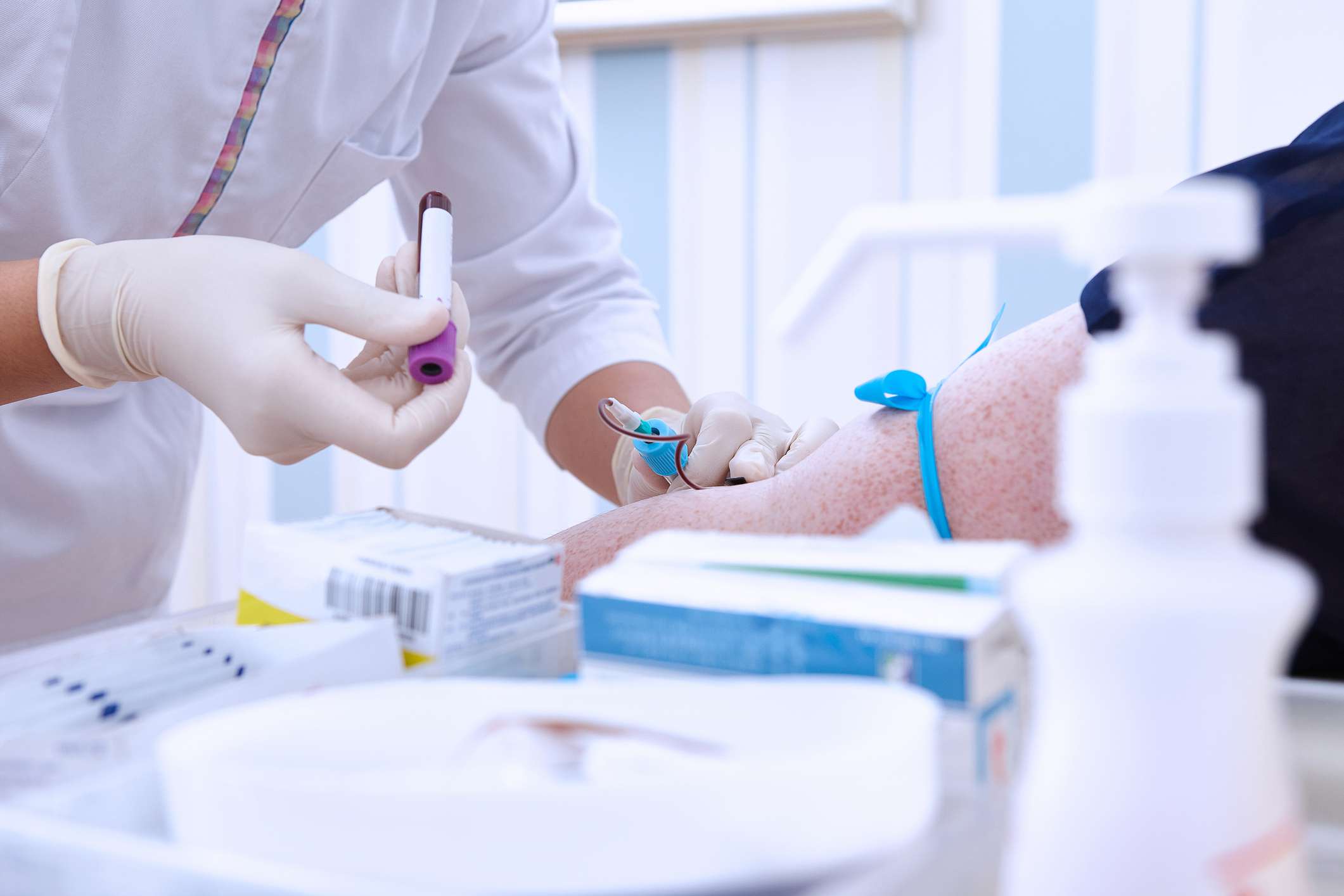 What do high immunoglobulin (IgE) levels mean for your health?