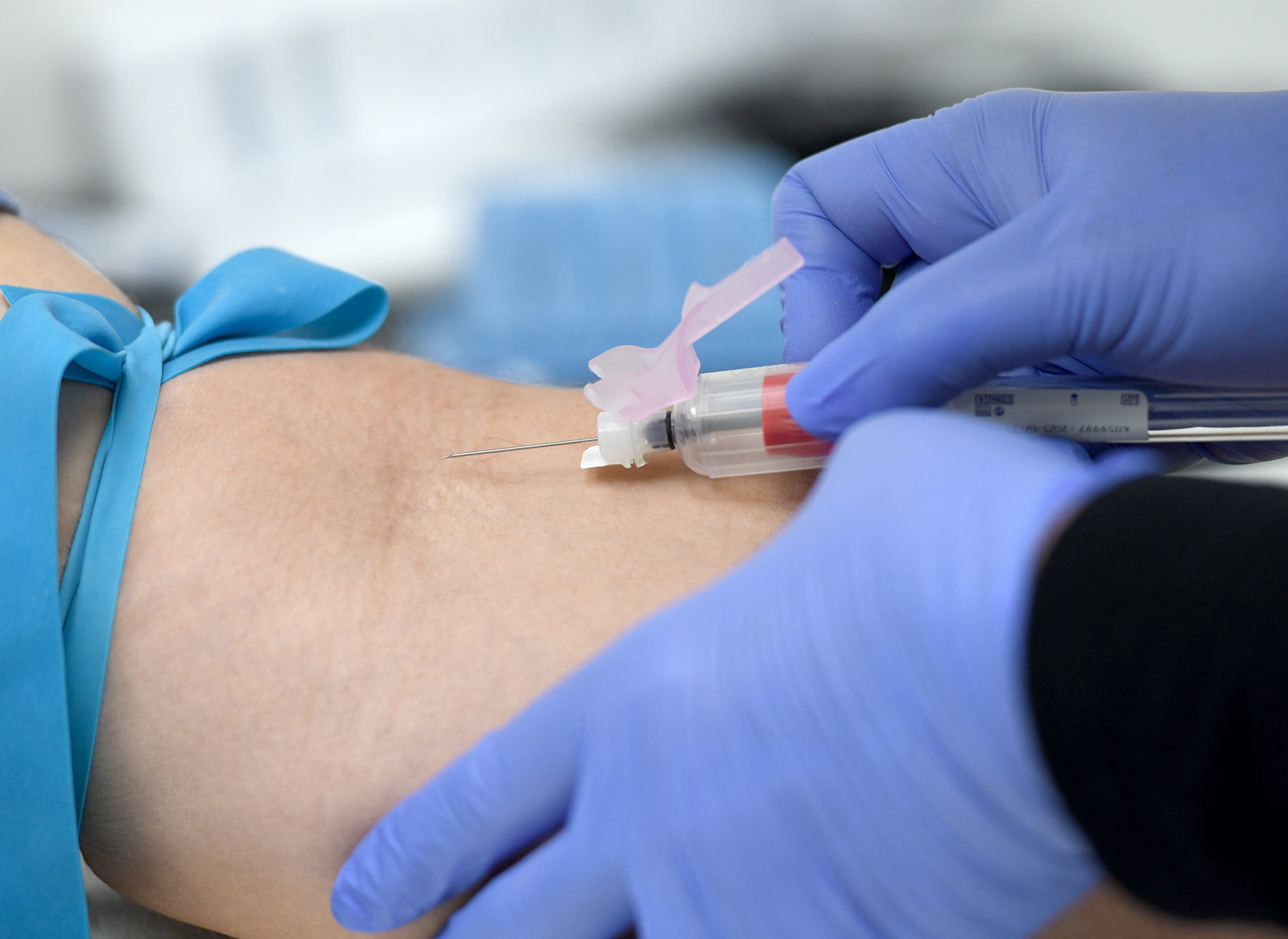 'It's pretty bad': Why are syphilis cases on the rise in Stark County ...