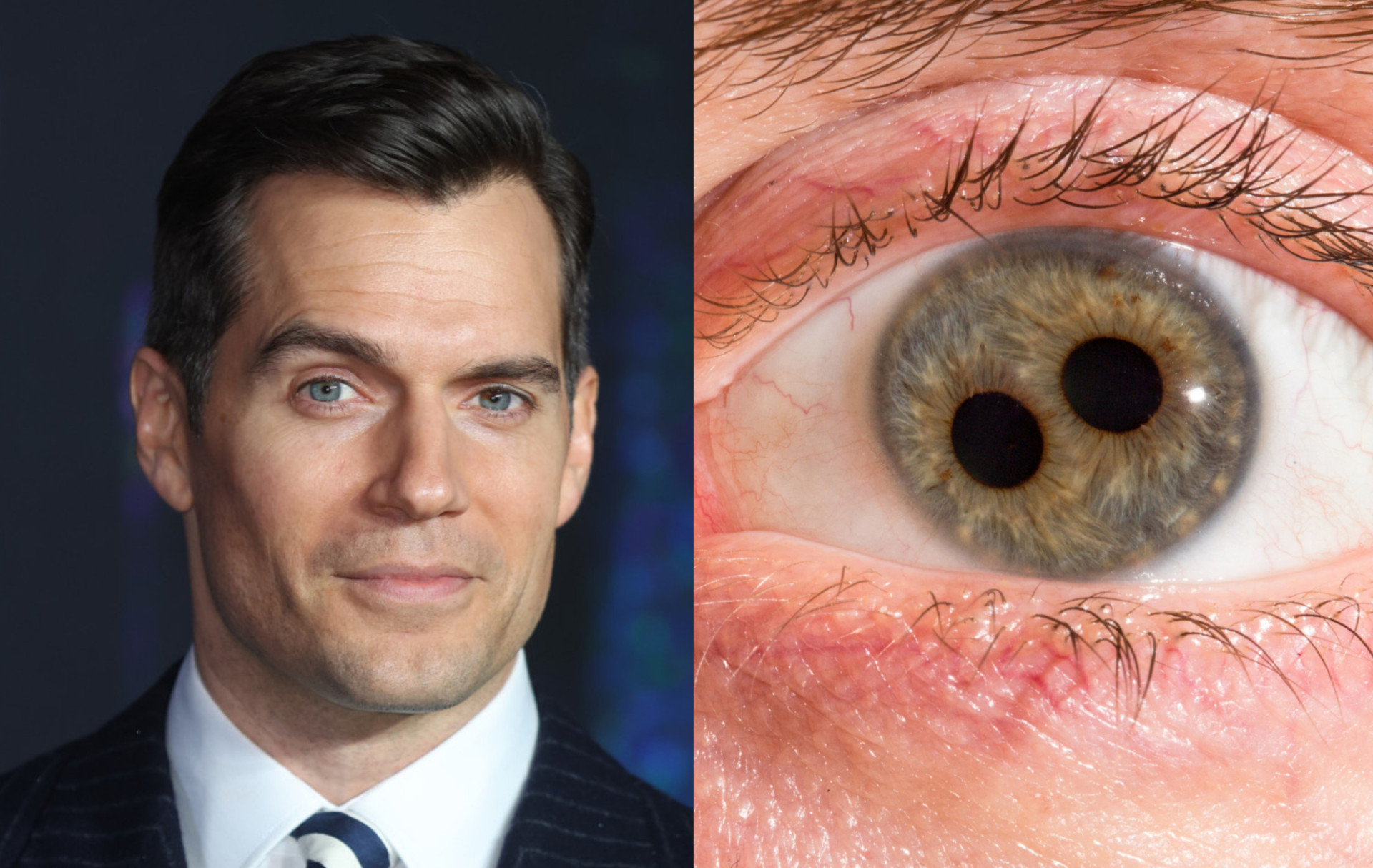 Zeldzame oogafwijkingen die je nog niet kende