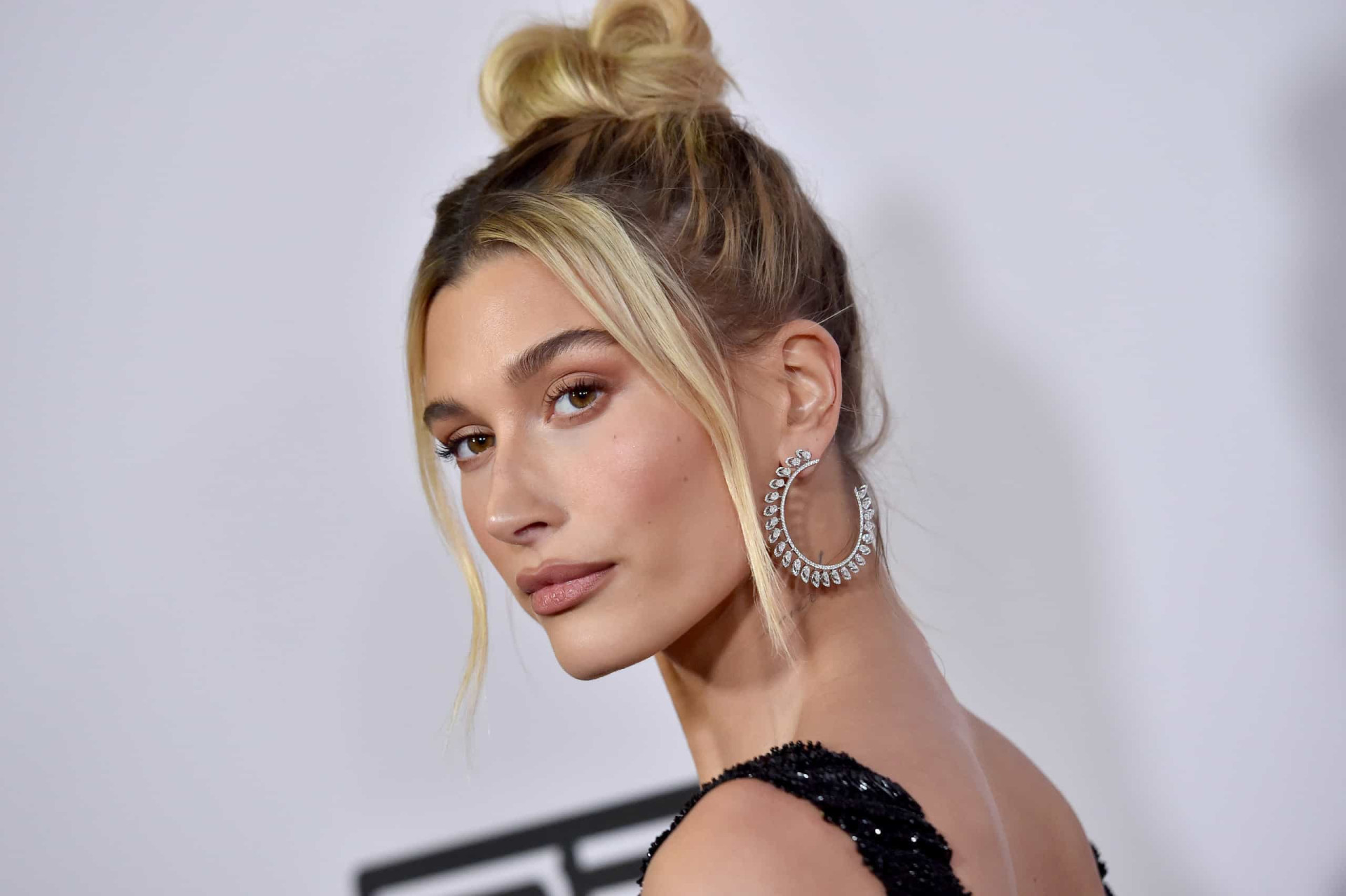 Celebrities who suffer from skin conditions