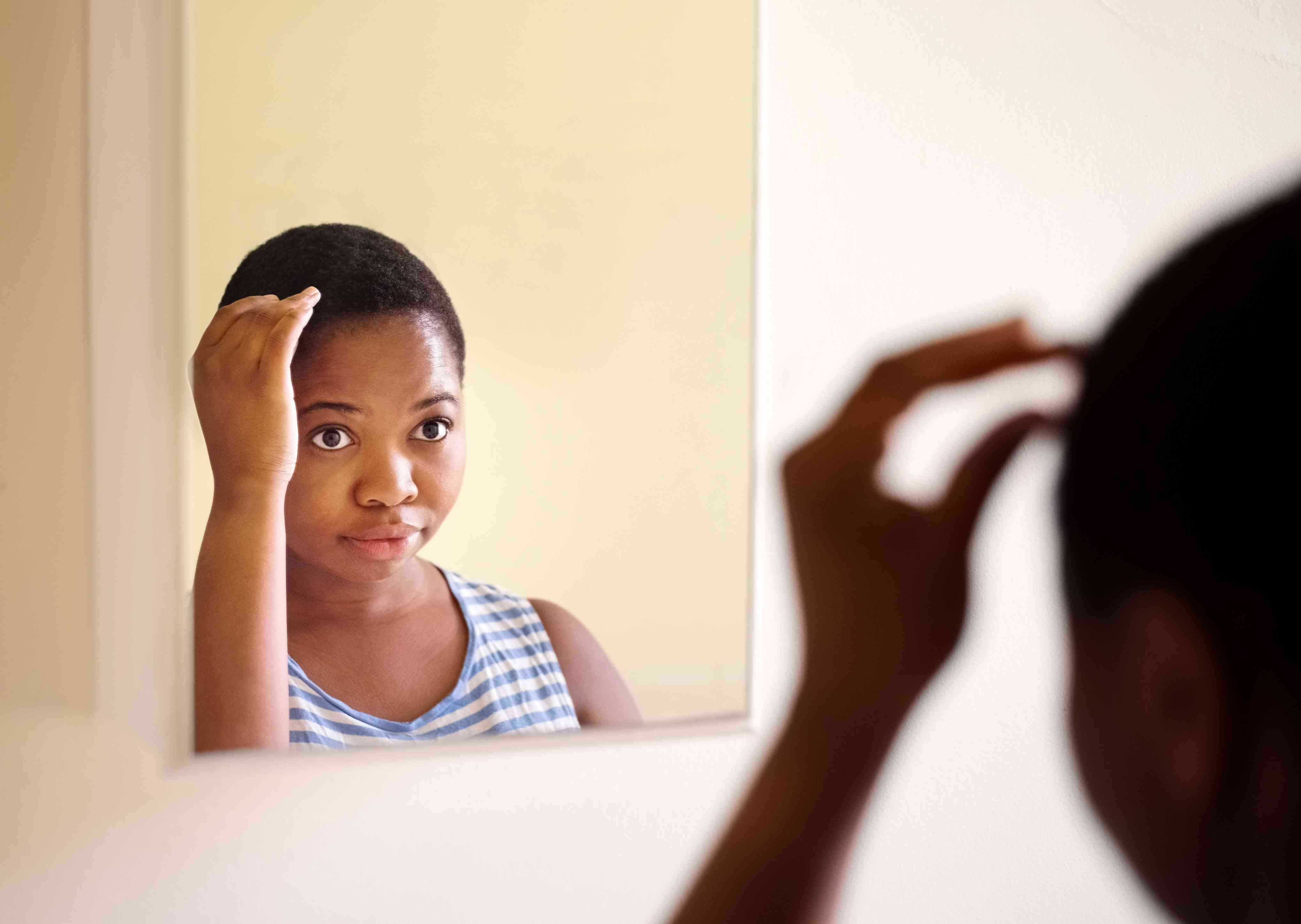 Understanding central centrifugal cicatricial alopecia (CCCA)