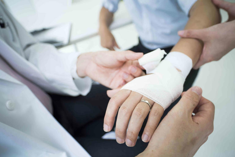 How to Recognize and Treat a Second-Degree Burn