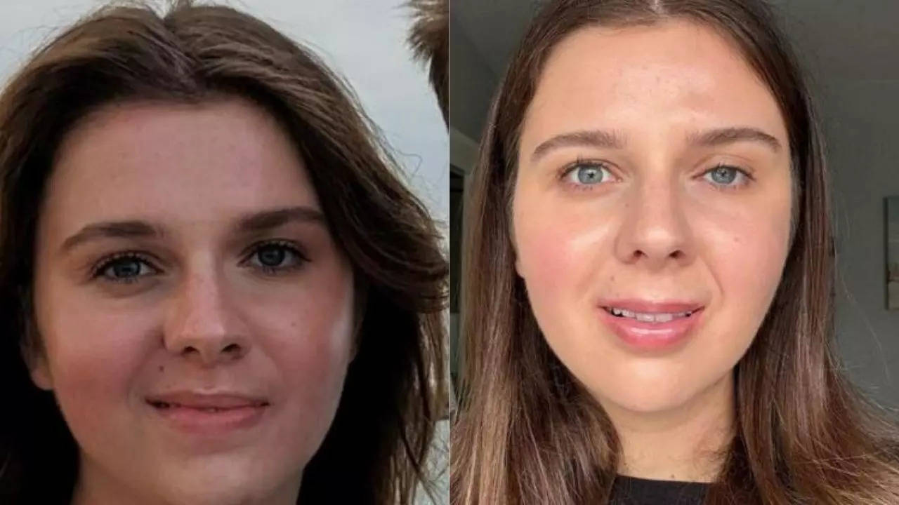 Teenager Who Heard Strange Noise In Her Ear Was Diagnosed With a Slow ... Teenager Who Heard Strange Noise In Her Ear Was Diagnosed With a Slow ...