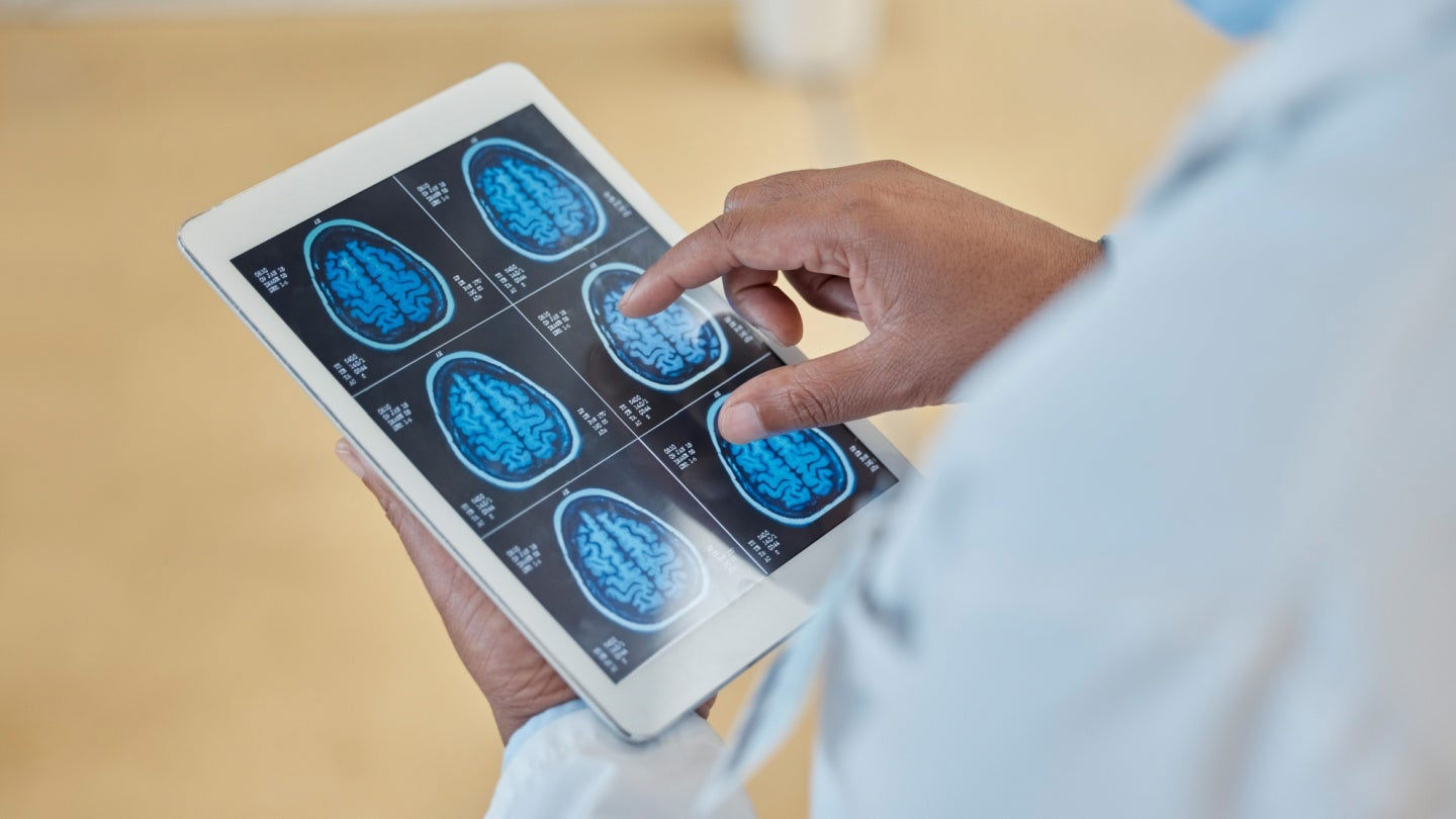 ESYA and Alamar partner for neurological biomarker detection and ... ESYA and Alamar partner for neurological biomarker detection and ...