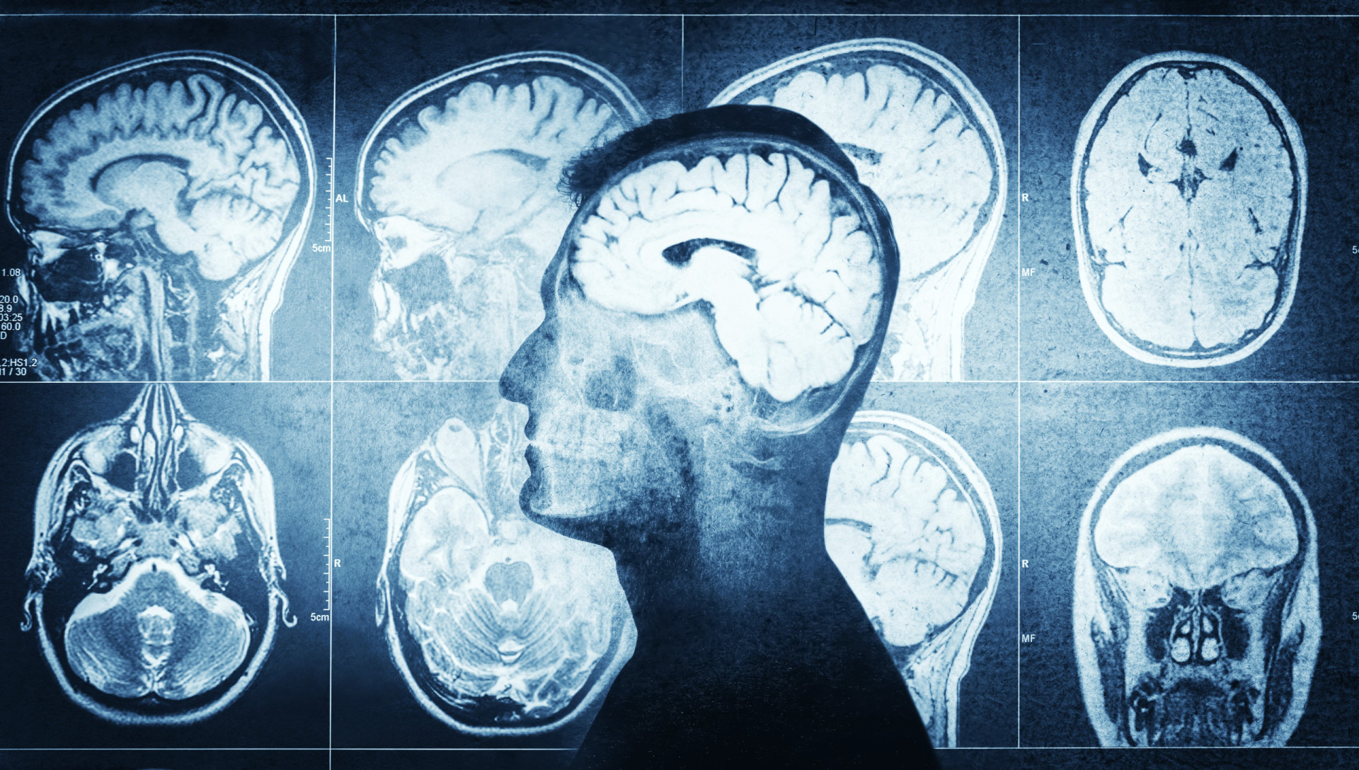 Learn the language of your mind using neuro-linguistic programming