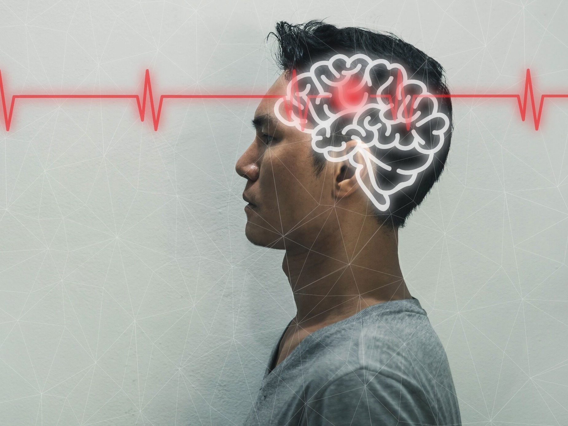 Pilne potrzeby neurologii na rok 2025. Co trzeci Polak zachoruje na ... Pilne potrzeby neurologii na rok 2025. Co trzeci Polak zachoruje na ...