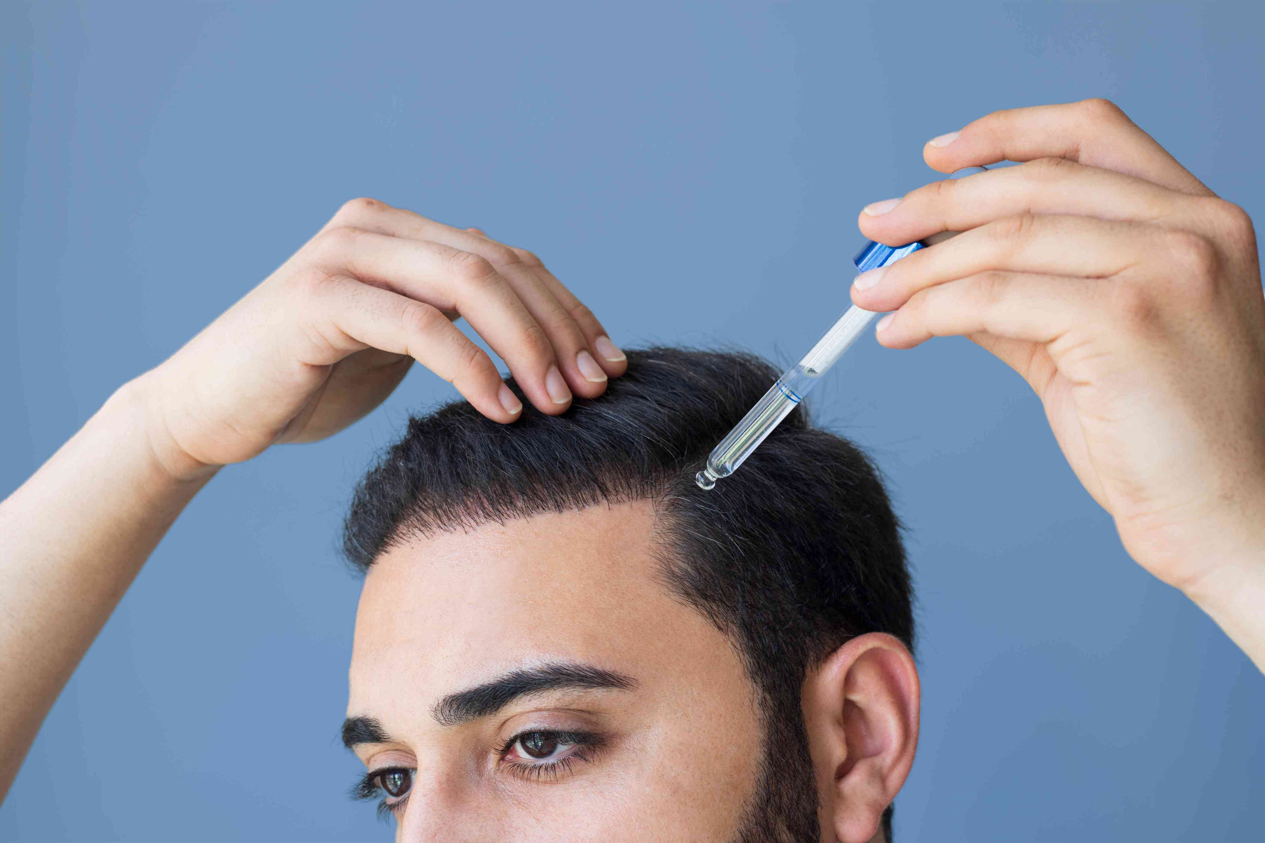 Scalp Oil Is a Game Changer for a Dry, Itchy Scalp—Here's How to ...