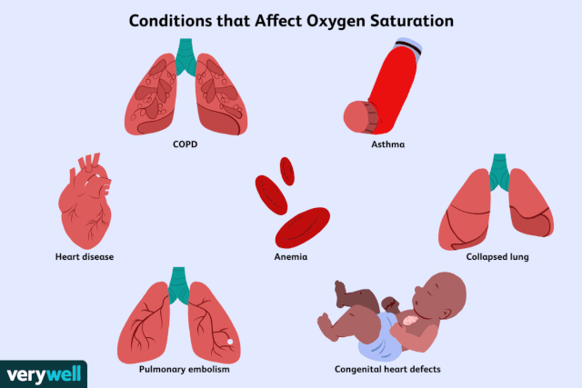 Why you shouldn't ignore low oxygen warning signs